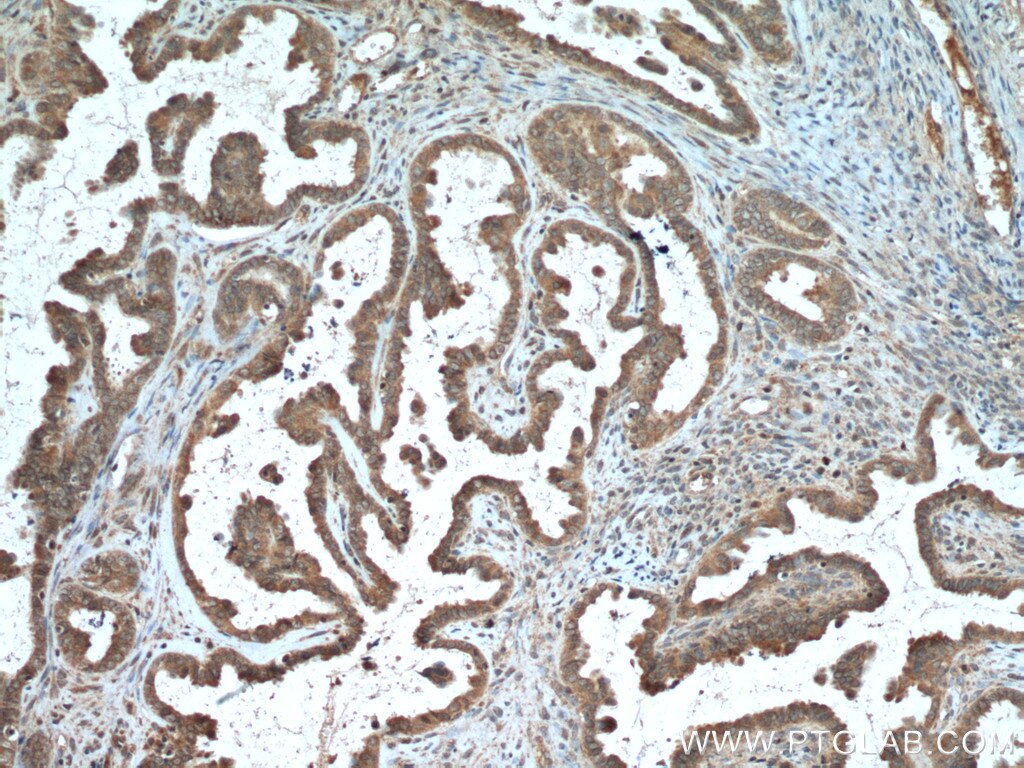 HAS1 antibody (15229-1-AP) | Proteintech