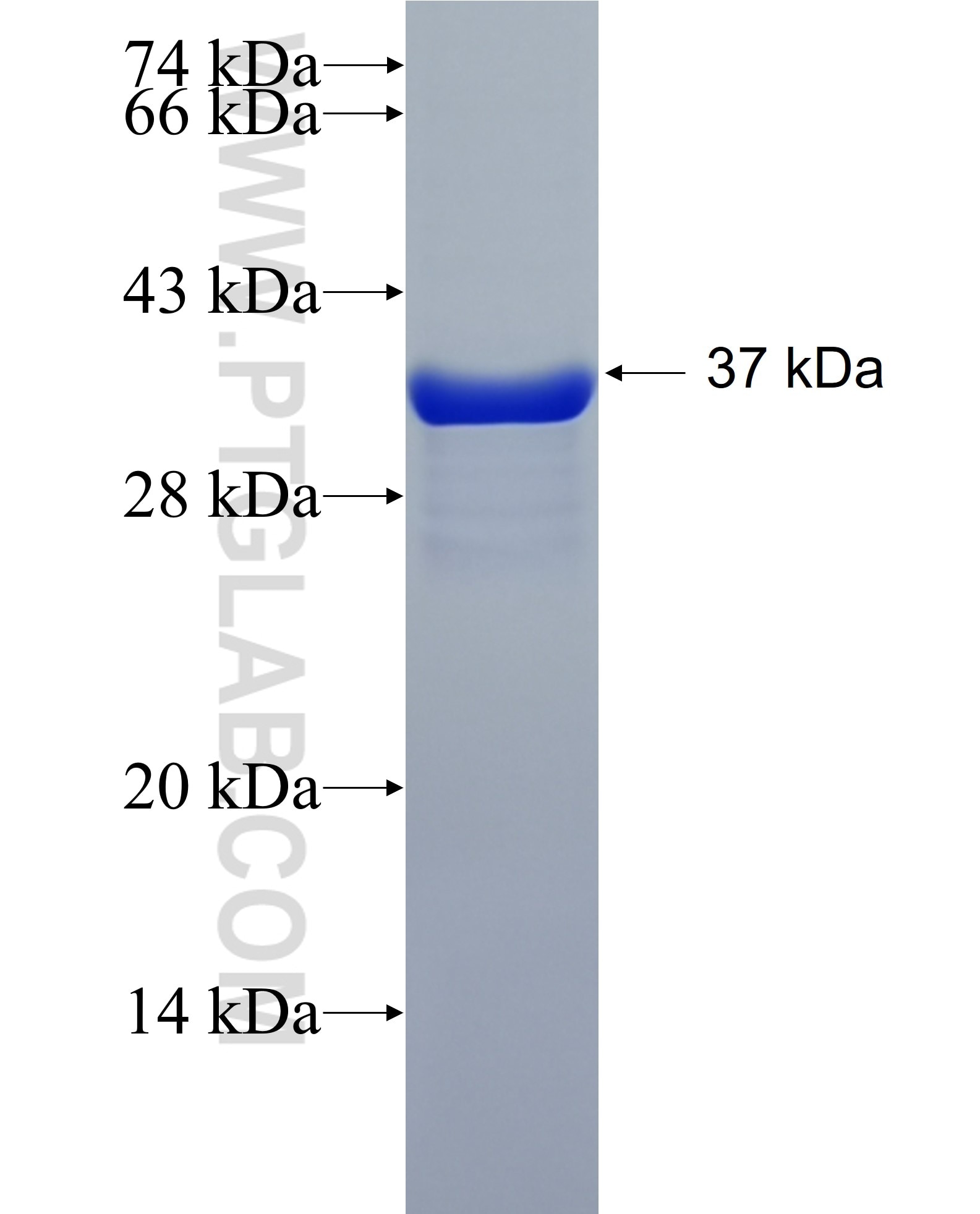 HDAC10 Fusion Protein Ag30214 | Proteintech