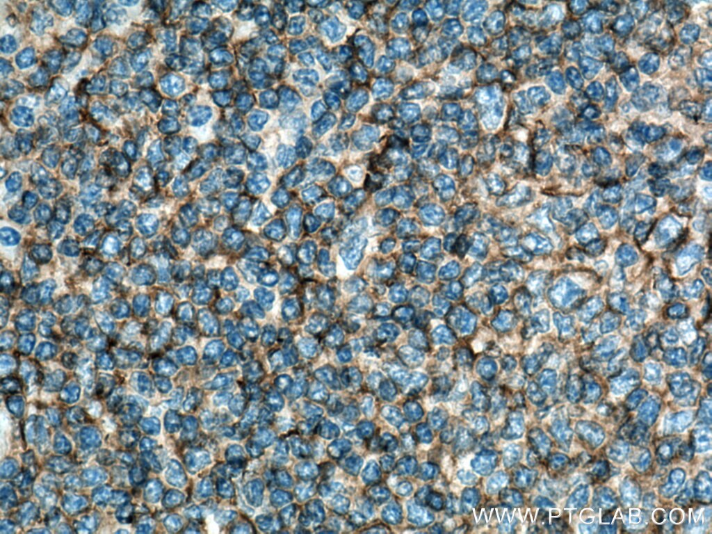 HLA class I ABC Antibody 15240-1-AP | Proteintech