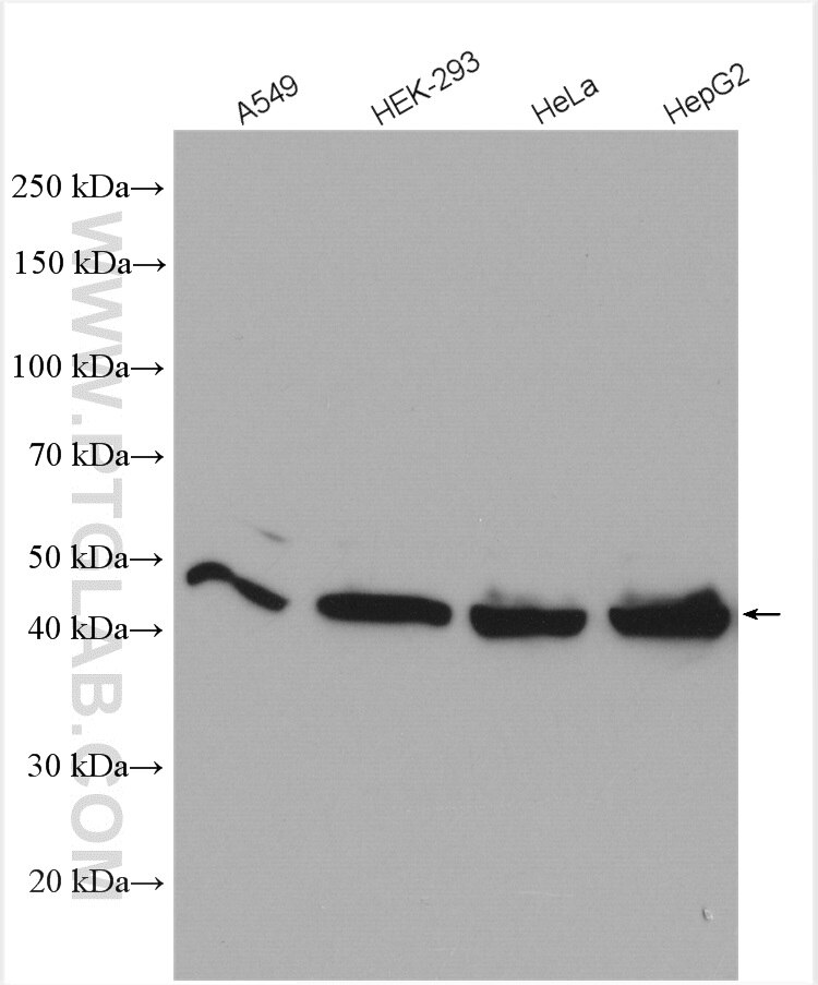 HLA class I ABC Antibody 15240-1-AP | Proteintech