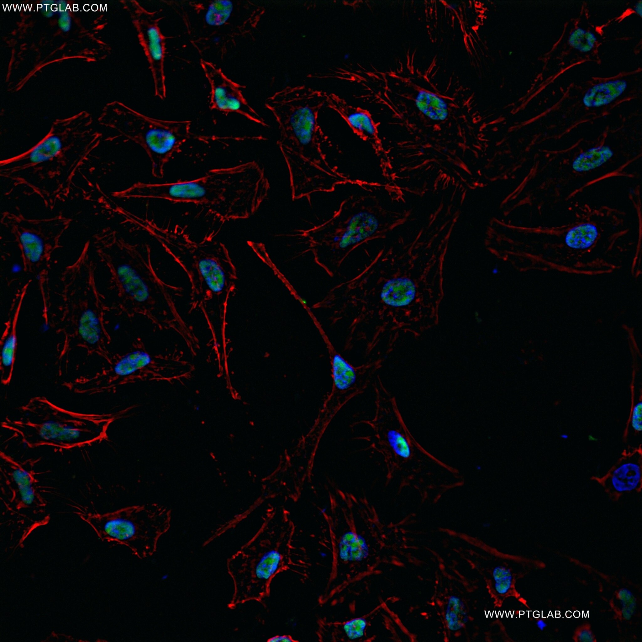HMGB1 antibody (82973-2-RR) | Proteintech