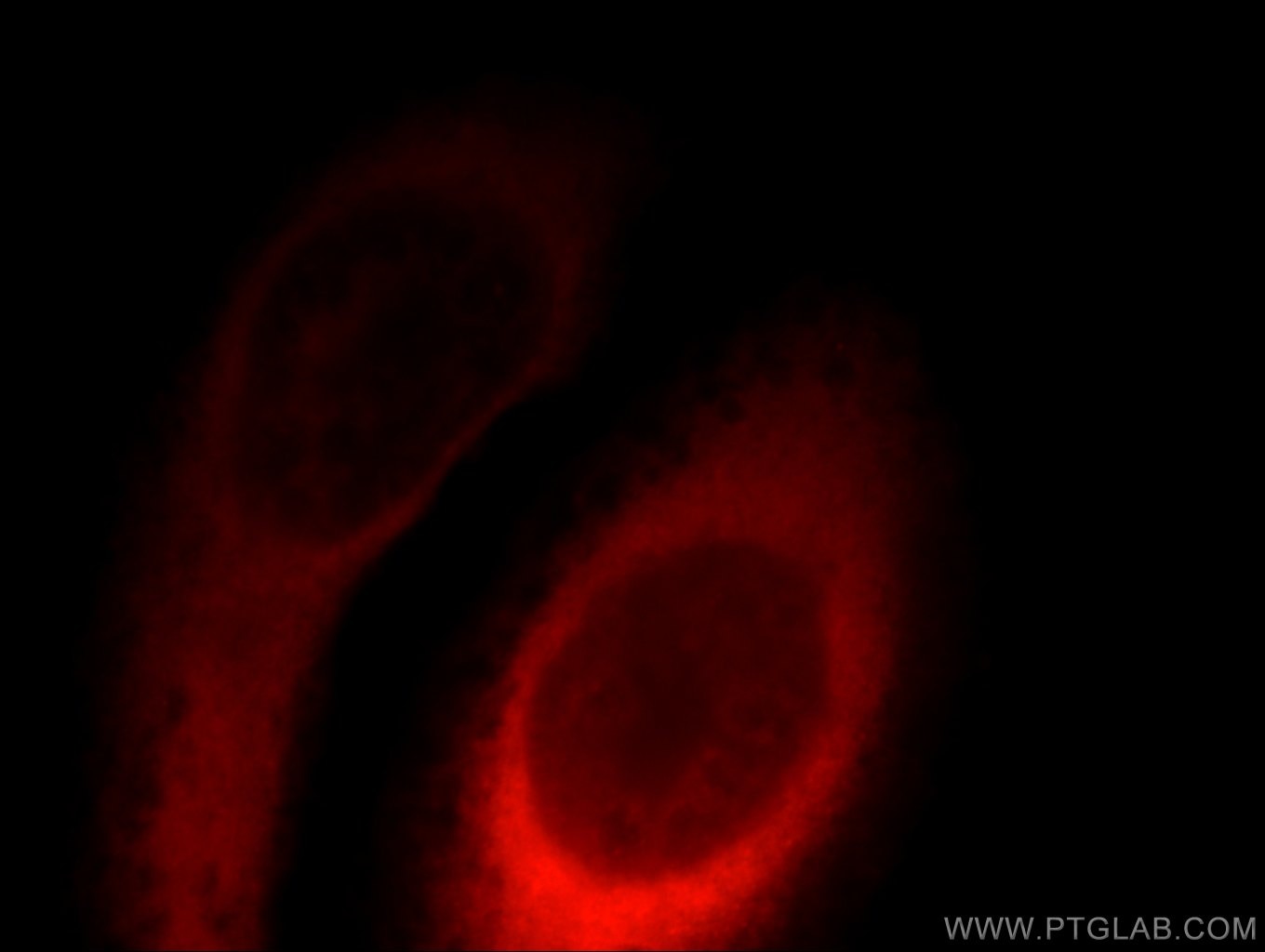 HPS1 Fusion Protein Ag7149 | Proteintech