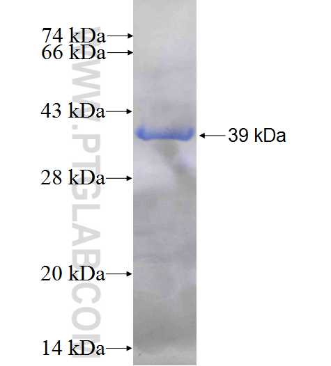 HSD17B4 Fusion Protein Ag7221 | Proteintech