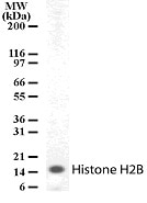Histone H2B antibody (pAb) | Proteintech