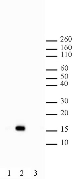Histone H2BK5ac antibody (pAb) | Proteintech