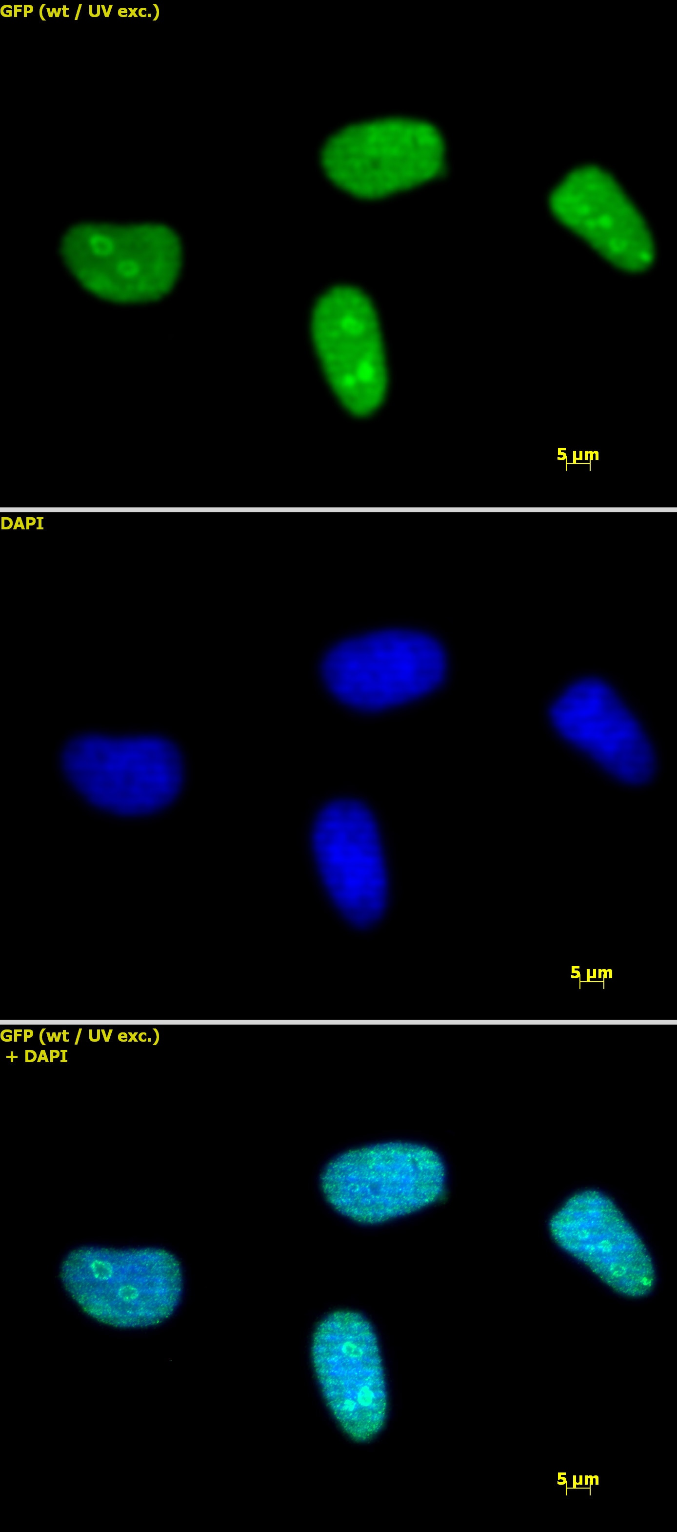 Histone H3K27me2 antibody (pAb) | Proteintech