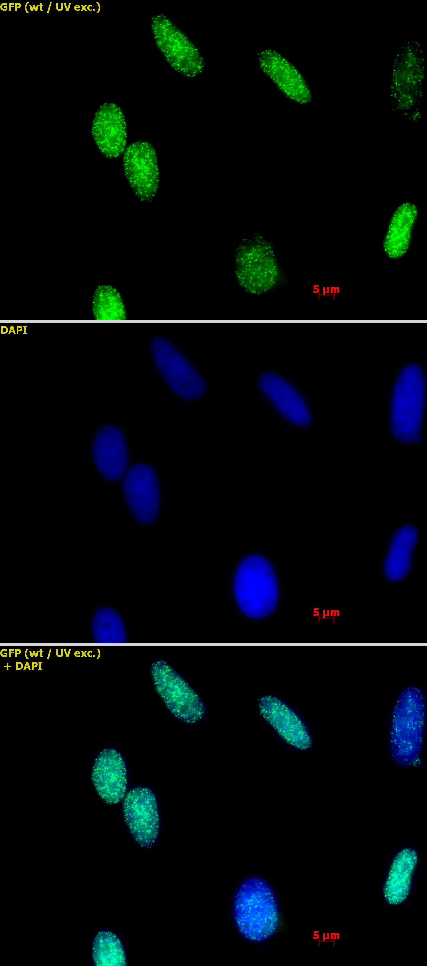 Histone H3K36me2 antibody (pAb) | Proteintech