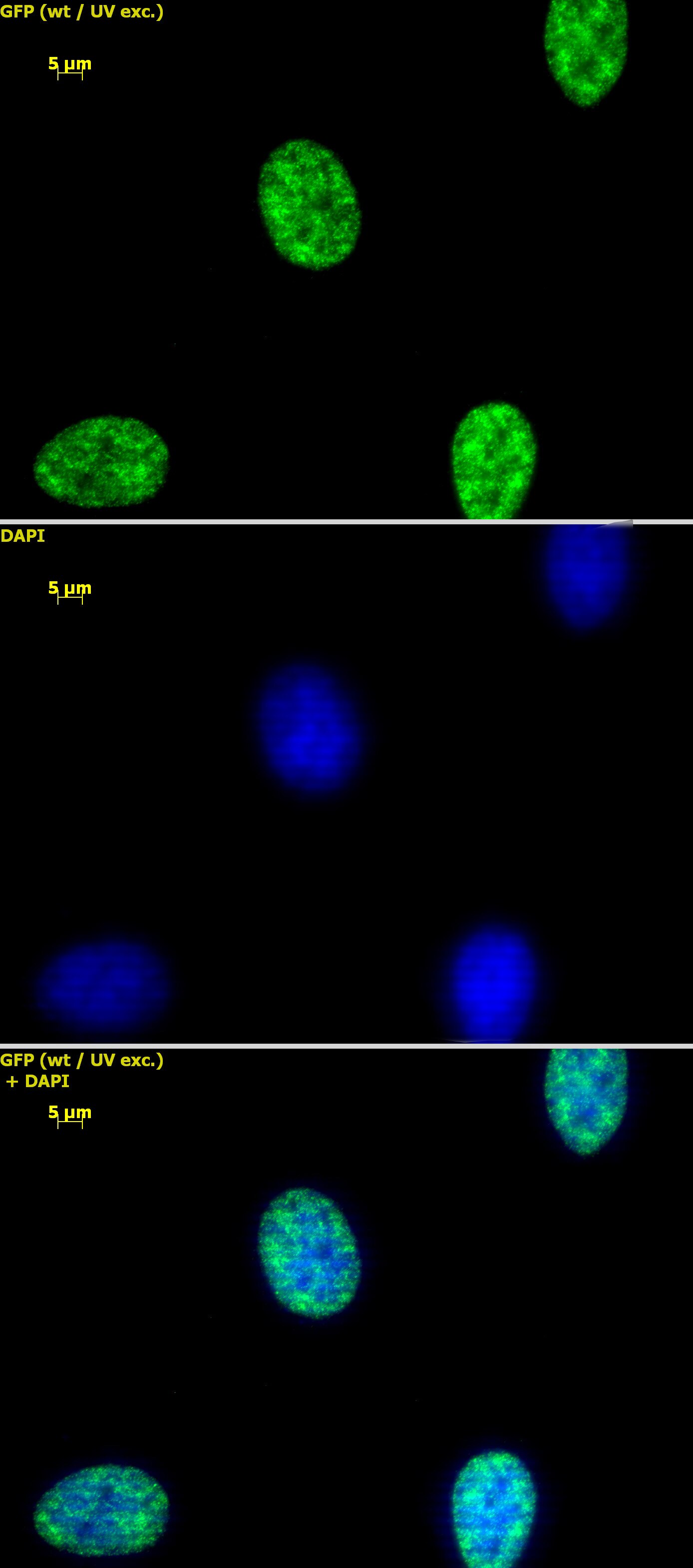 Histone H3K4me2 antibody (pAb) | Proteintech