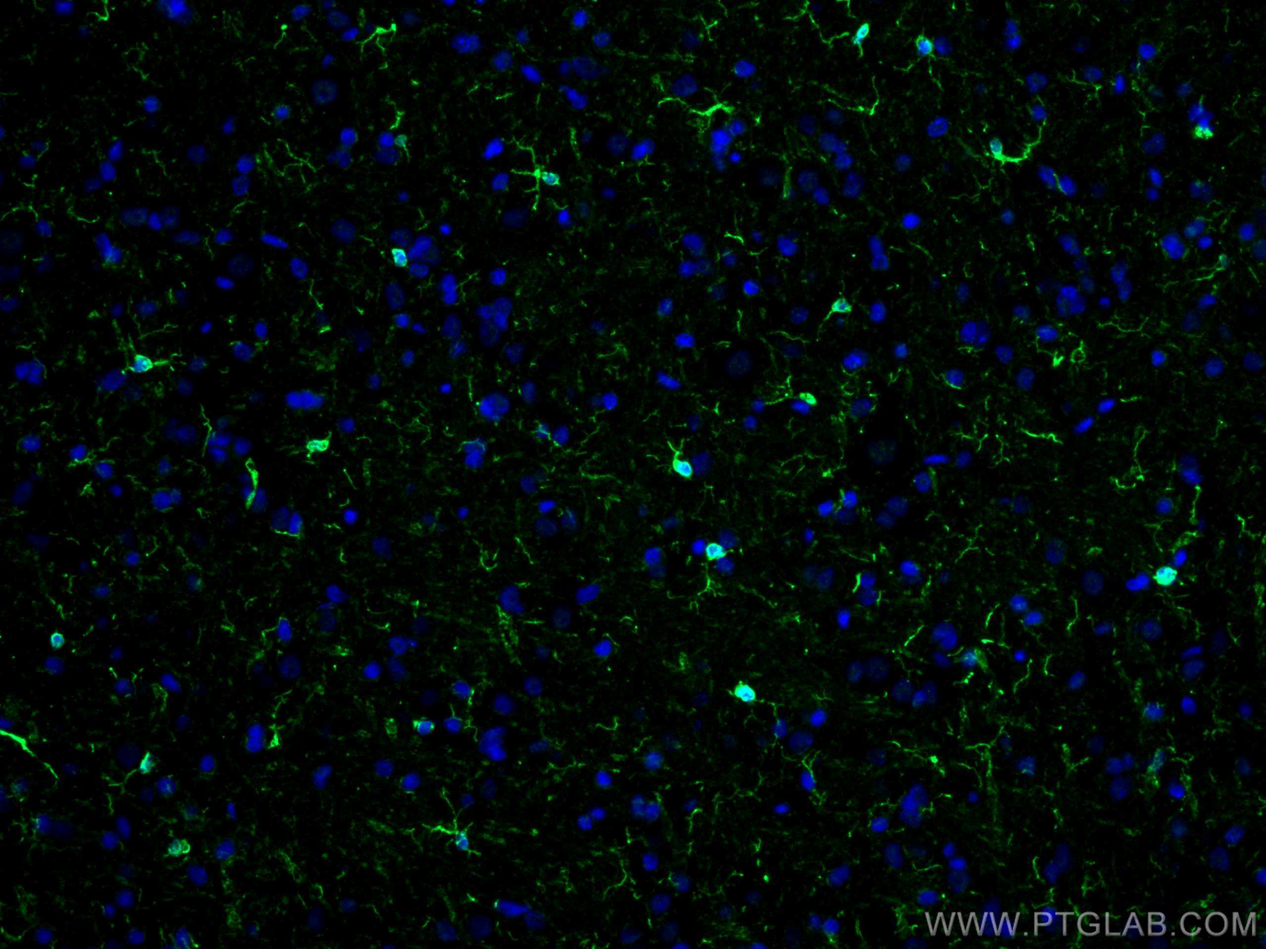 IBA1 antibody (10904-1-AP) | Proteintech