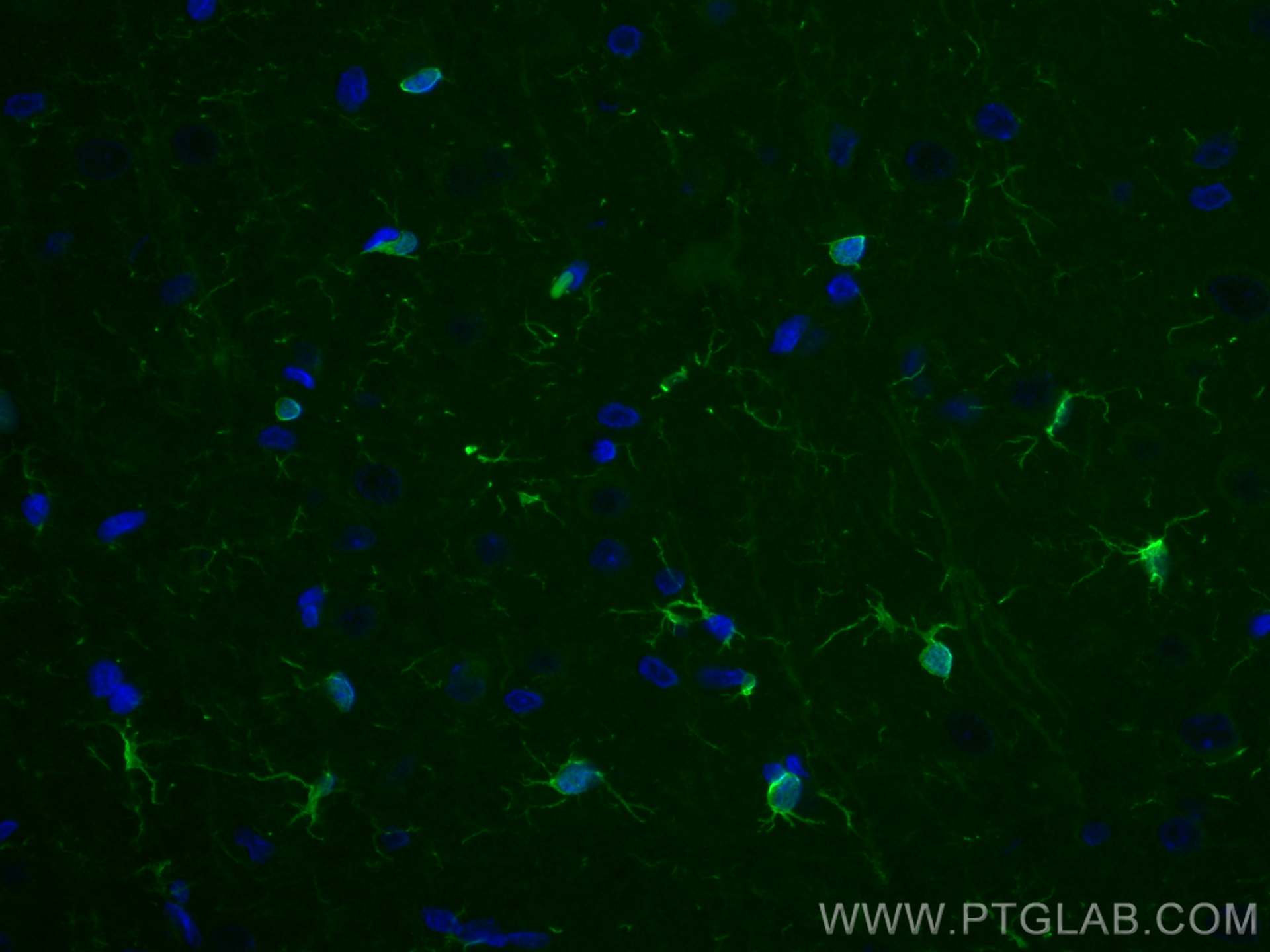 IBA1 antibody (CL488-81728) | Proteintech