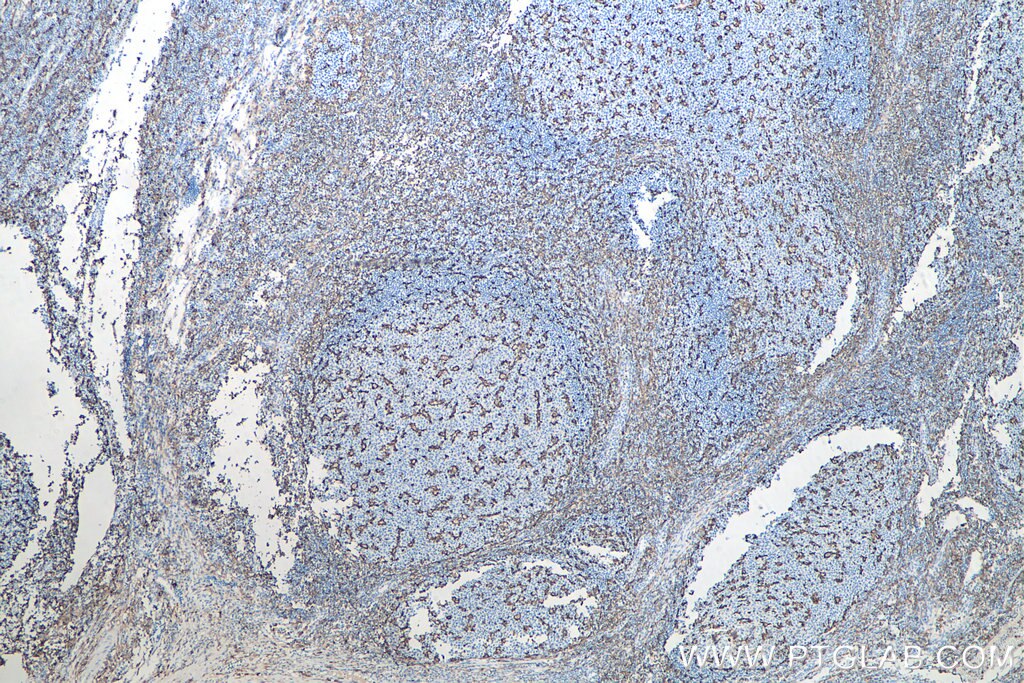 IHCeasy CD11c Ready-To-Use IHC Kit - United Bio Research