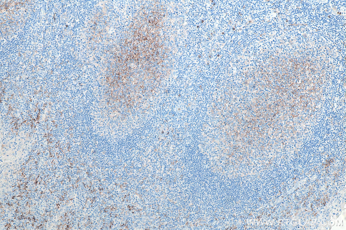 IHCeasy CD14 Ready-To-Use IHC Kit - United Bio Research