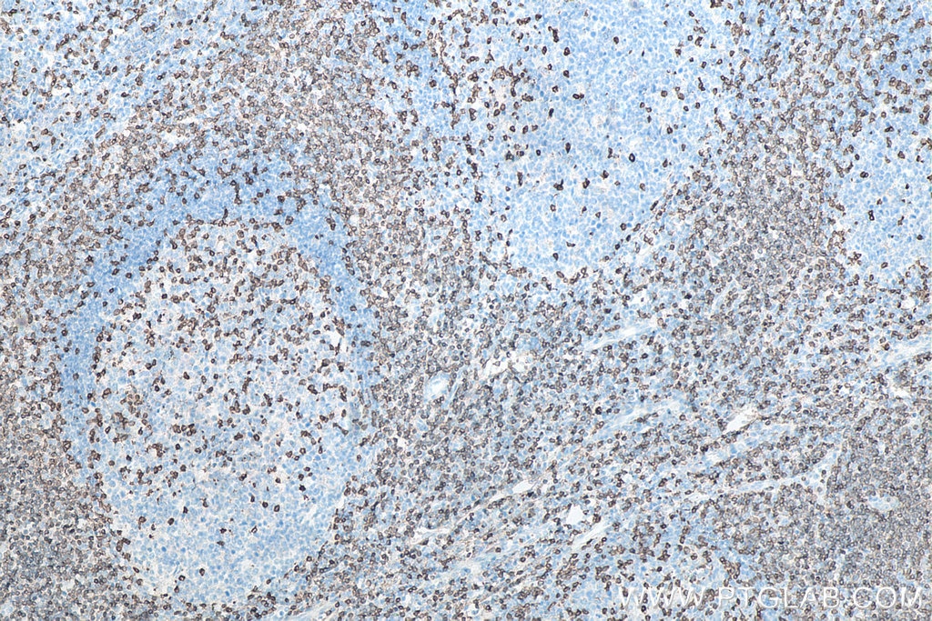 IHCeasy CD3 Ready-To-Use IHC Kit - United Bio Research