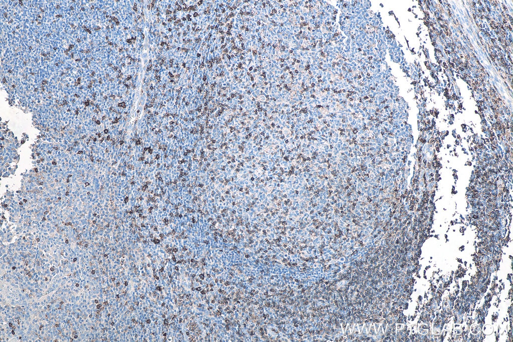 IHCeasy CD43 Ready-To-Use IHC Kit - United Bio Research