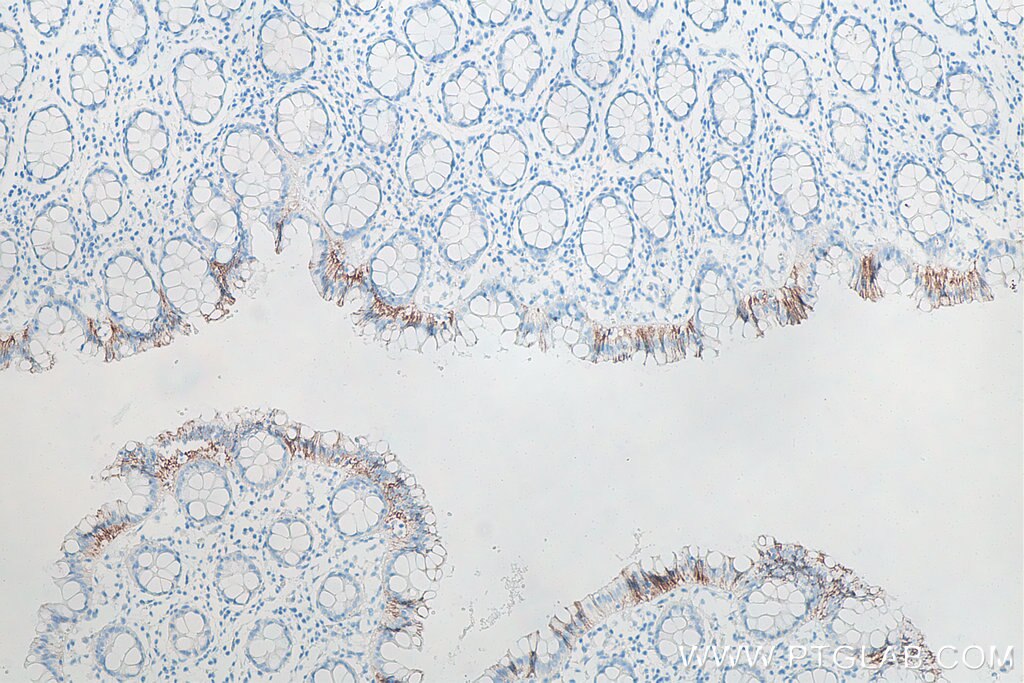 IHCeasy E-cadherin Ready-To-Use IHC Kit KHC0010 | Proteintech