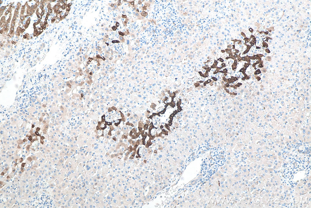 IHCeasy GLUL Ready-To-Use IHC Kit - United Bio Research