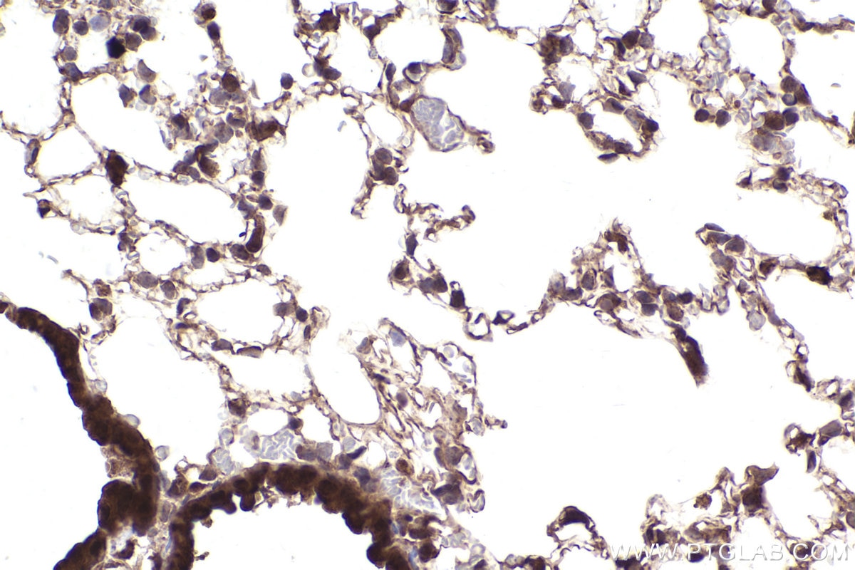 IHCeasy NFE2L2/NRF2 Ready-To-Use IHC Kit KHC2502 | Proteintech