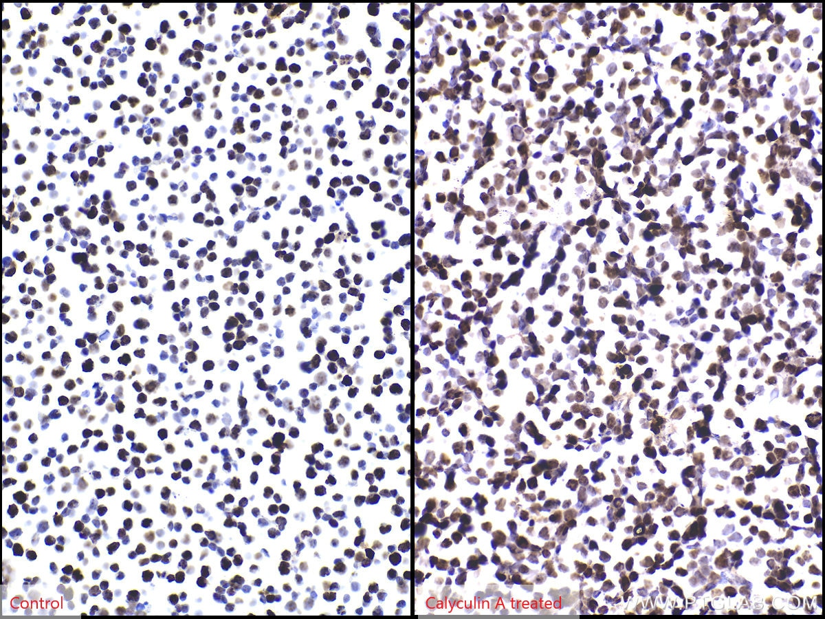 IHCeasy Phospho-Histone H2A.X (Ser139) Ready-To-Use IHC Kit KHC2276 ...