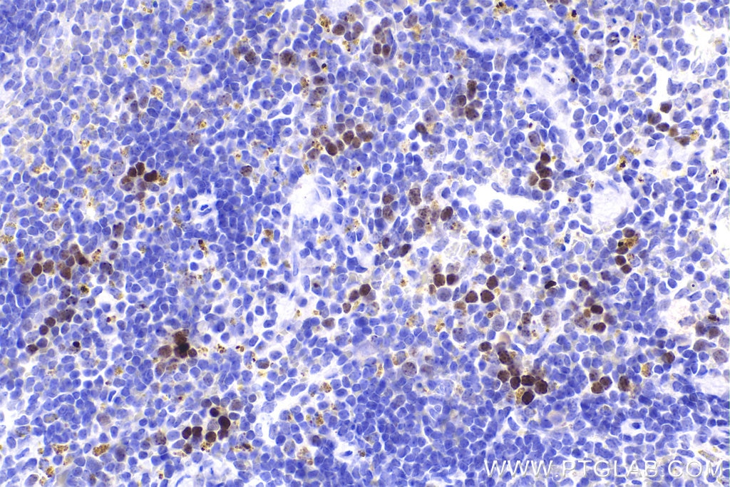 IHCeasy Phospho-Histone H2A.X (Ser139) Ready-To-Use IHC Kit KHC2276 ...