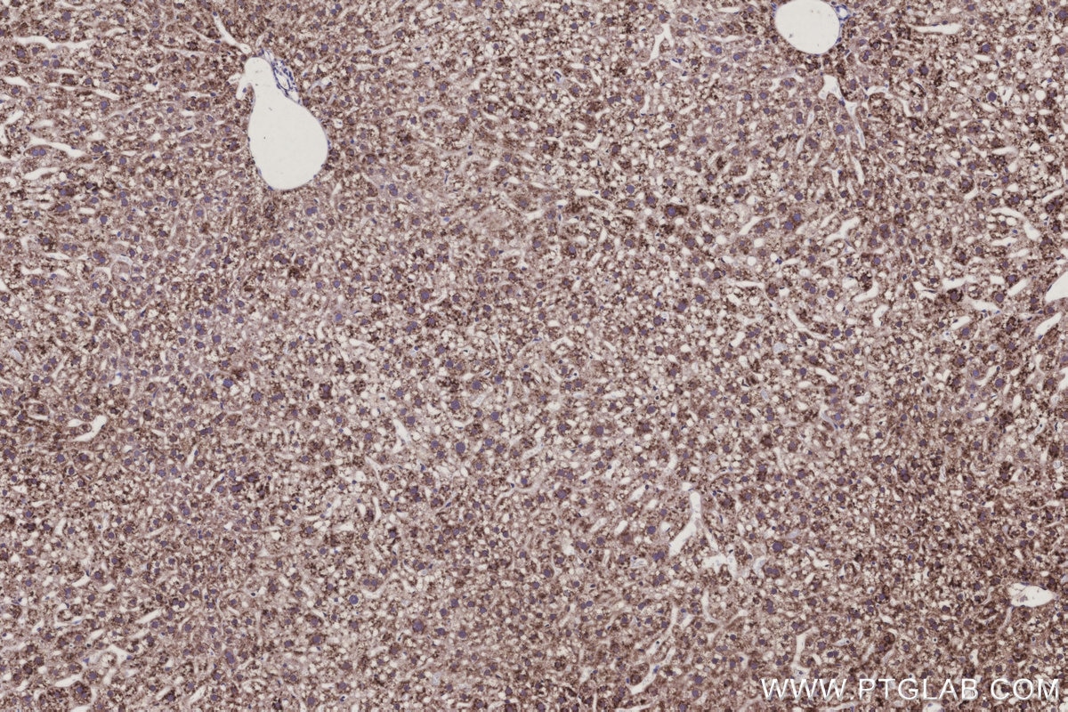 IHCeasy® SSR3 Ready-To-Use IHC Kit KHC3121 | Proteintech