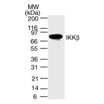 IKKb antibody (mAb) (Clone 10AG2) | Proteintech