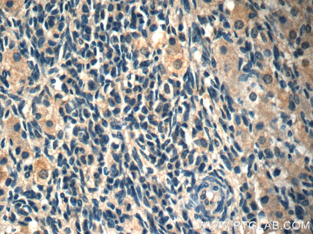 IL-36 Gamma antibody (60248-1-Ig) | Proteintech