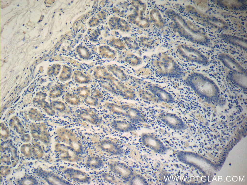 IL-36 Gamma antibody (60248-1-Ig) | Proteintech