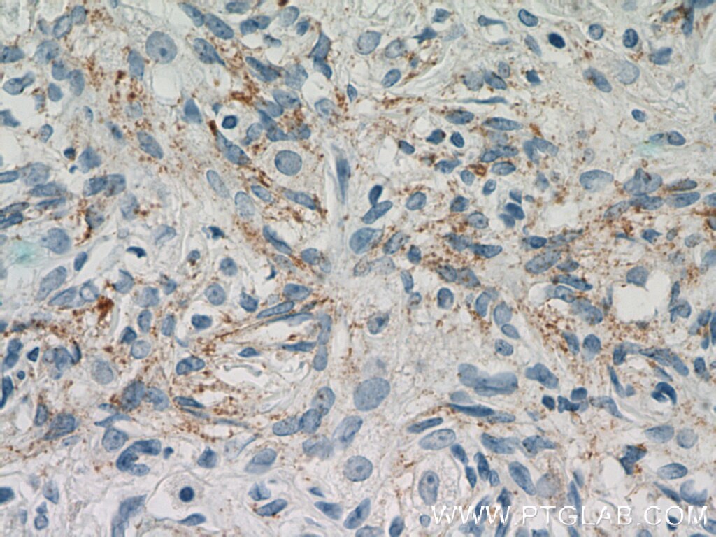 Inhibin alpha antibody (10609-1-AP) | Proteintech