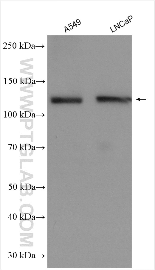 IRE1; ERN1 antibody (27528-1-AP) | Proteintech