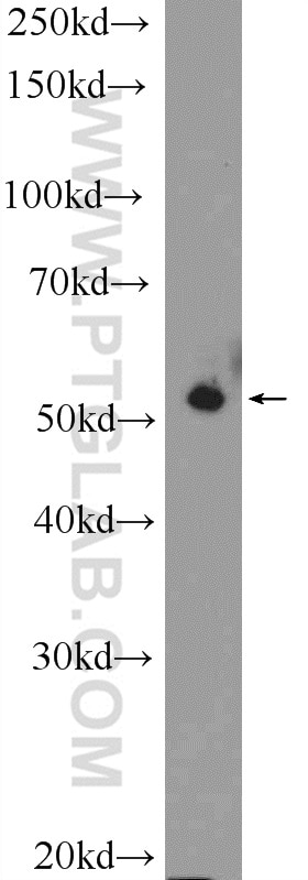 IRF6 antibody (12928-1-AP) | Proteintech