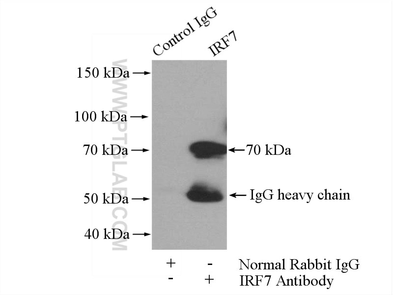 IRF7 Antibody 22392-1-AP | Proteintech