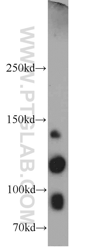 Integrin Alpha 3 antibody (21992-1-AP) | Proteintech