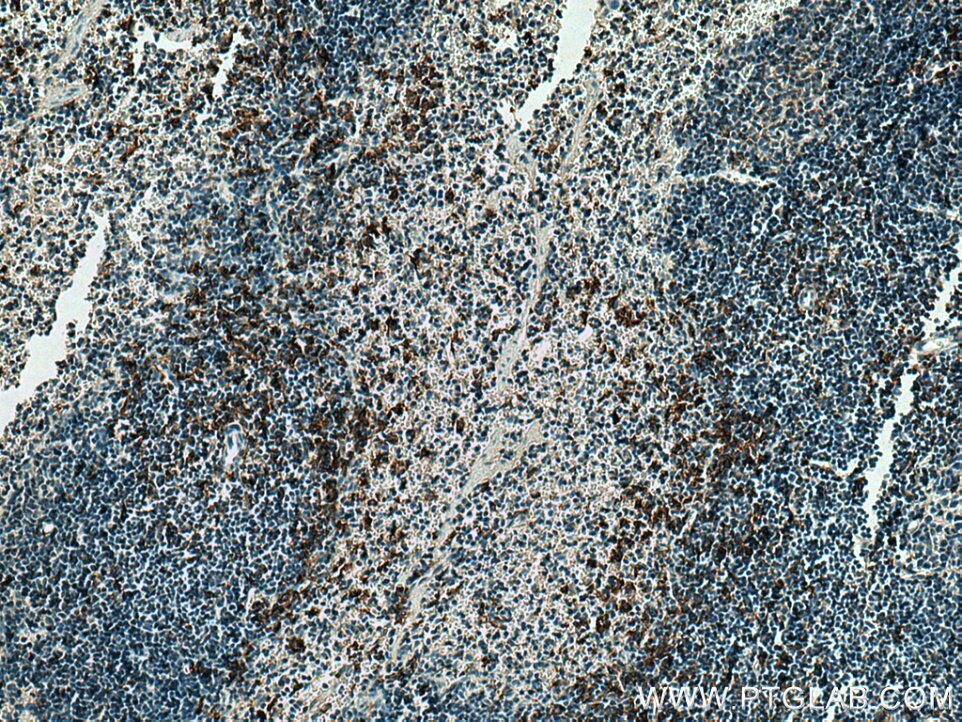 CD11c/Integrin Alpha X antibody (17342-1-AP) | Proteintech