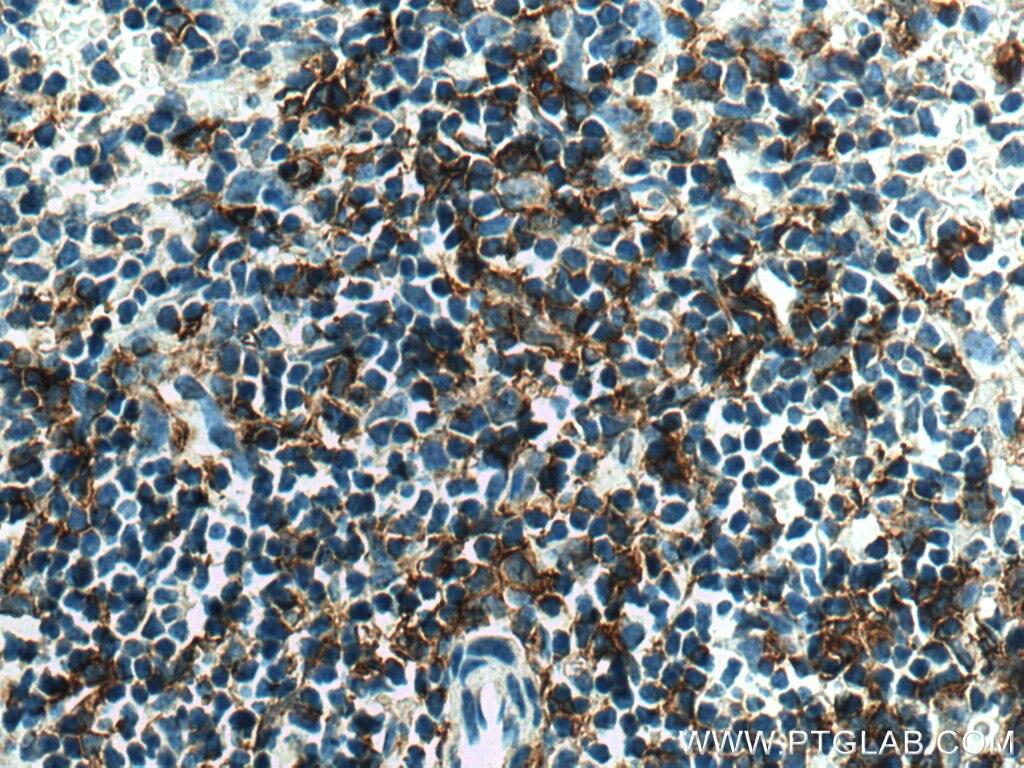 CD11c/Integrin Alpha X antibody (17342-1-AP) | Proteintech