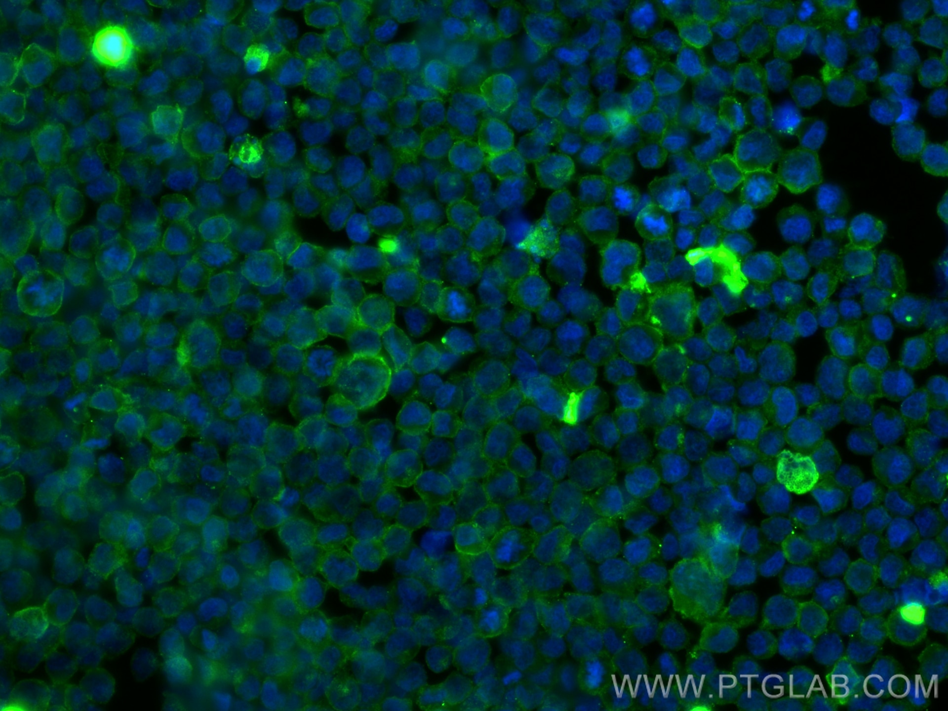 ICAM-1/CD54 antibody (10020-1-AP) | Proteintech
