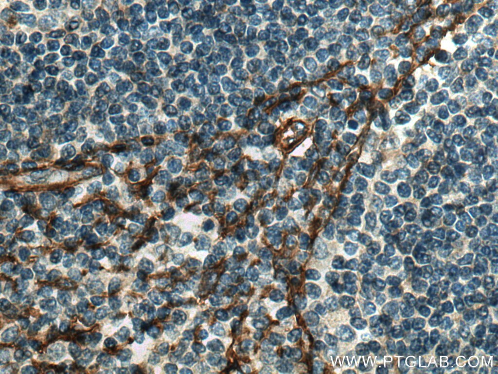 Integrin alpha-1 Fusion Protein Ag30631 | Proteintech