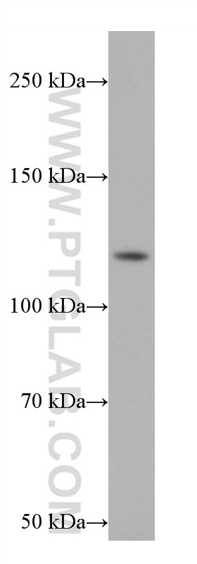 Integrin alpha-6 Fusion Protein Ag25866 | Proteintech