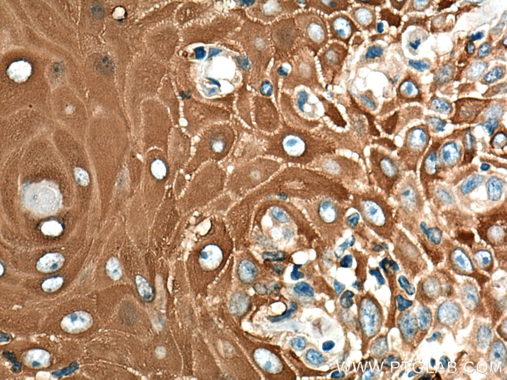 Involucrin antibody (28462-1-AP) | Proteintech