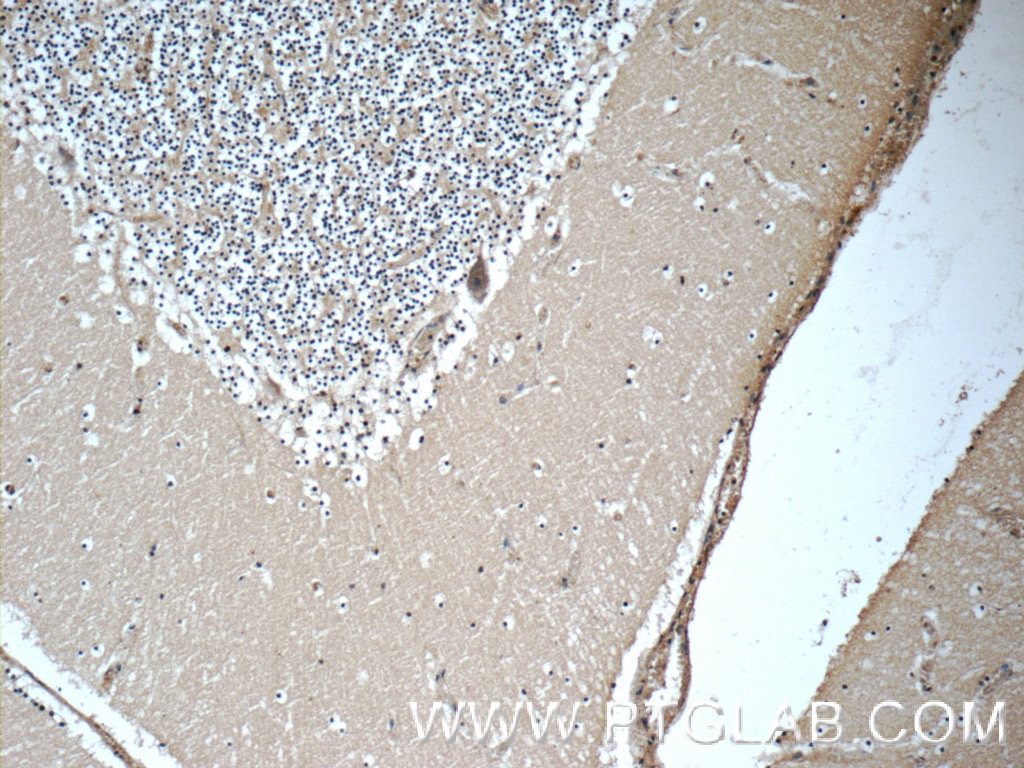 JTV1 antibody (10424-1-AP) | Proteintech