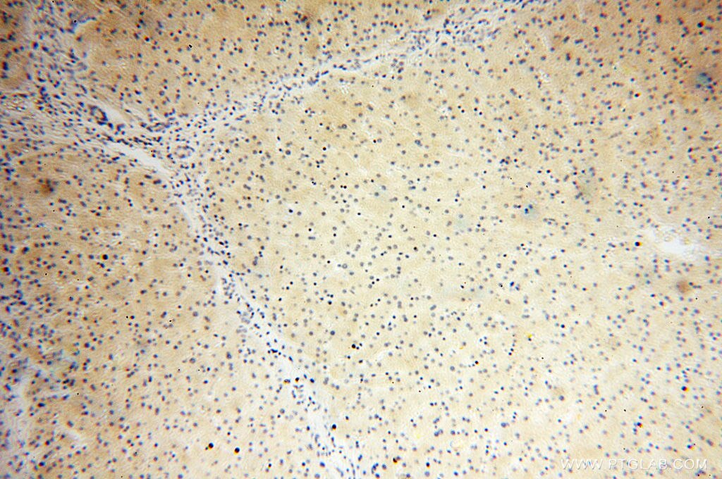 JTV1 Fusion Protein Ag21281 | Proteintech