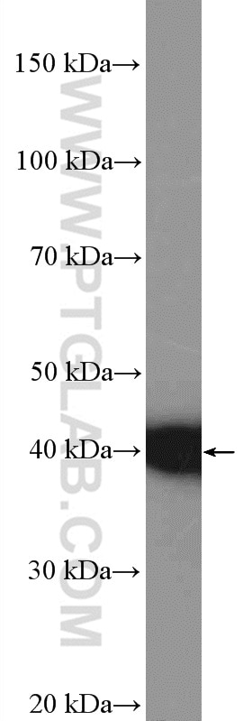 JTV1 antibody (10424-1-AP) | Proteintech