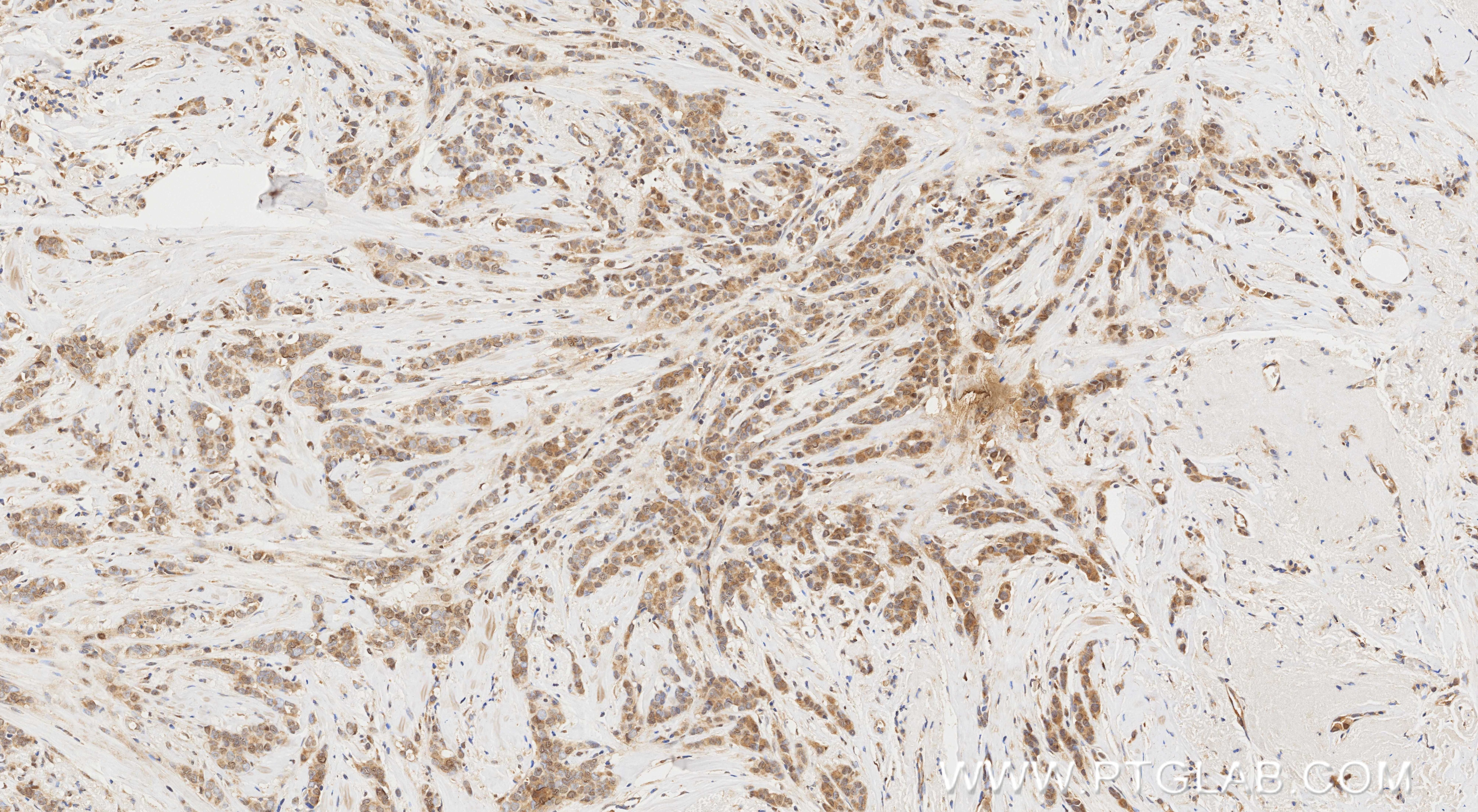 JUN antibody (81667-5-RR) | Proteintech