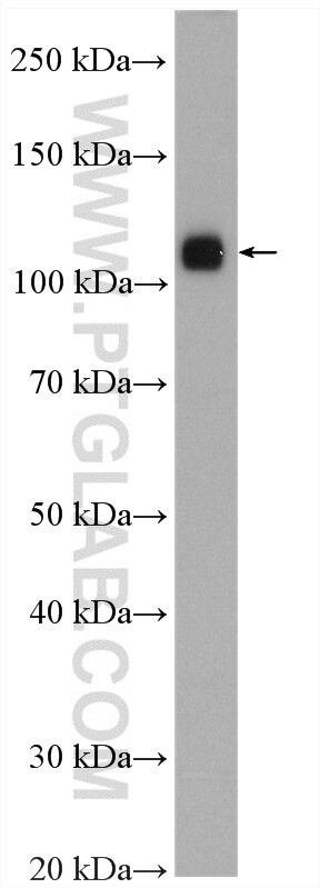 KDM1 antibody (20813-1-AP) | Proteintech