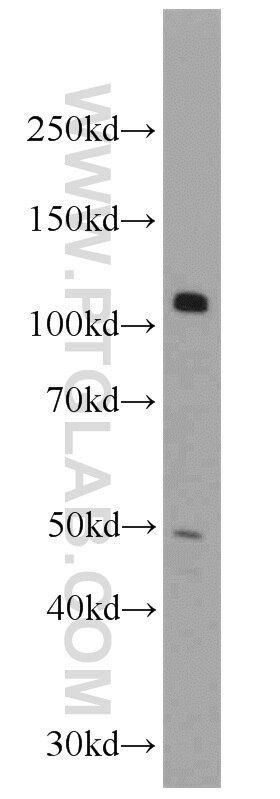 KDM1 antibody (20813-1-AP) | Proteintech