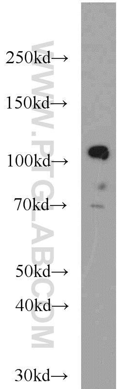 KDM1 antibody (20813-1-AP) | Proteintech