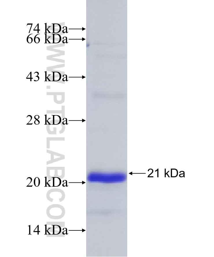 KEAP1 Fusion Protein Ag32533 | Proteintech