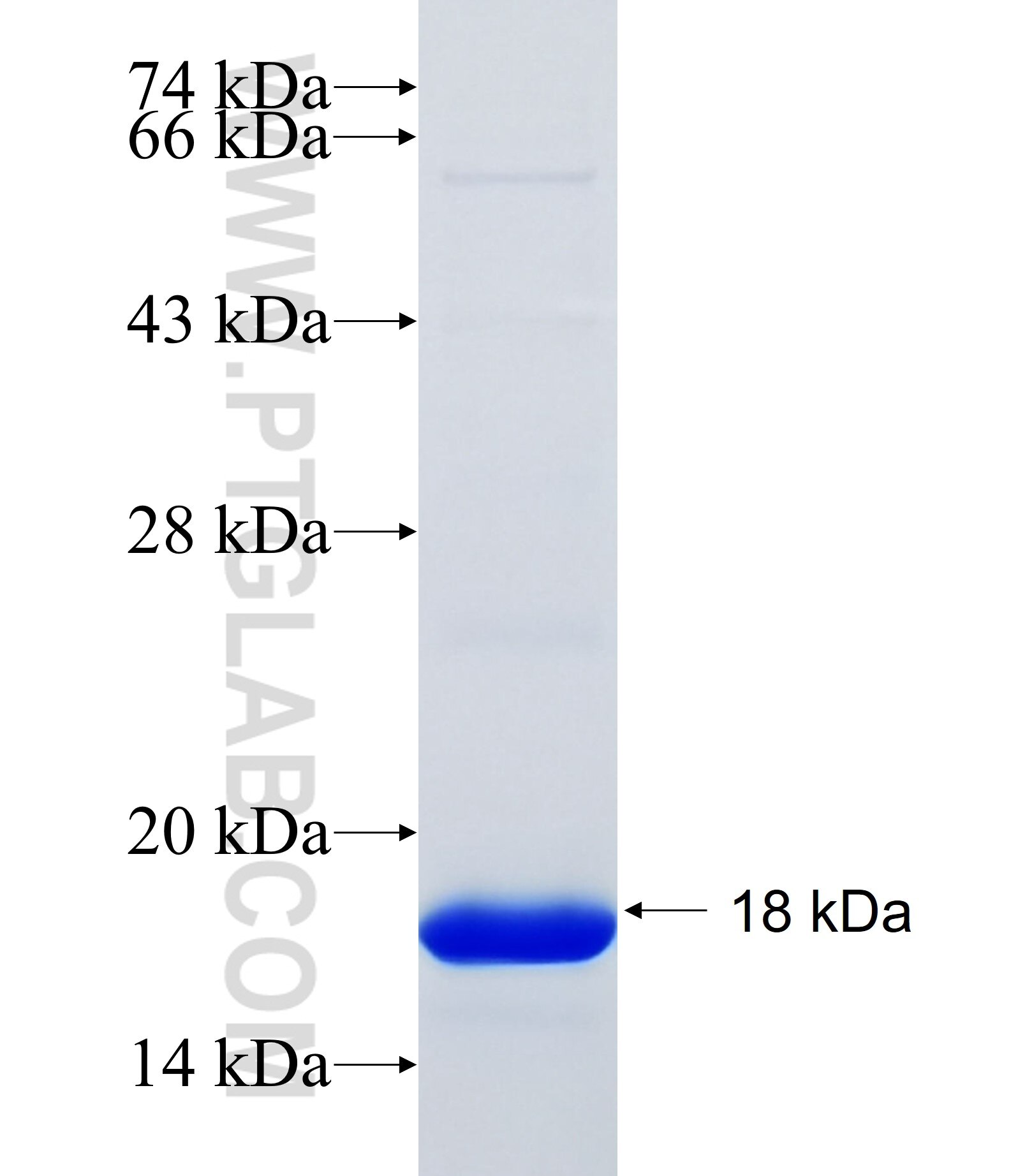 KERA Fusion Protein Ag34244 | Proteintech