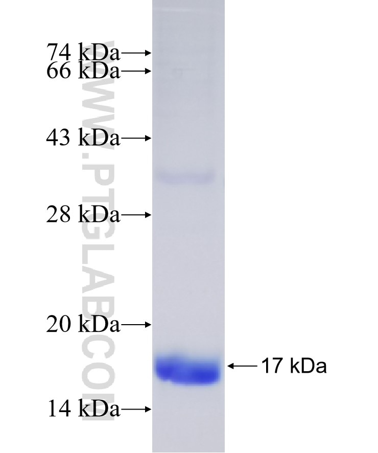 Kdm2b Fusion Protein Ag33378 | Proteintech