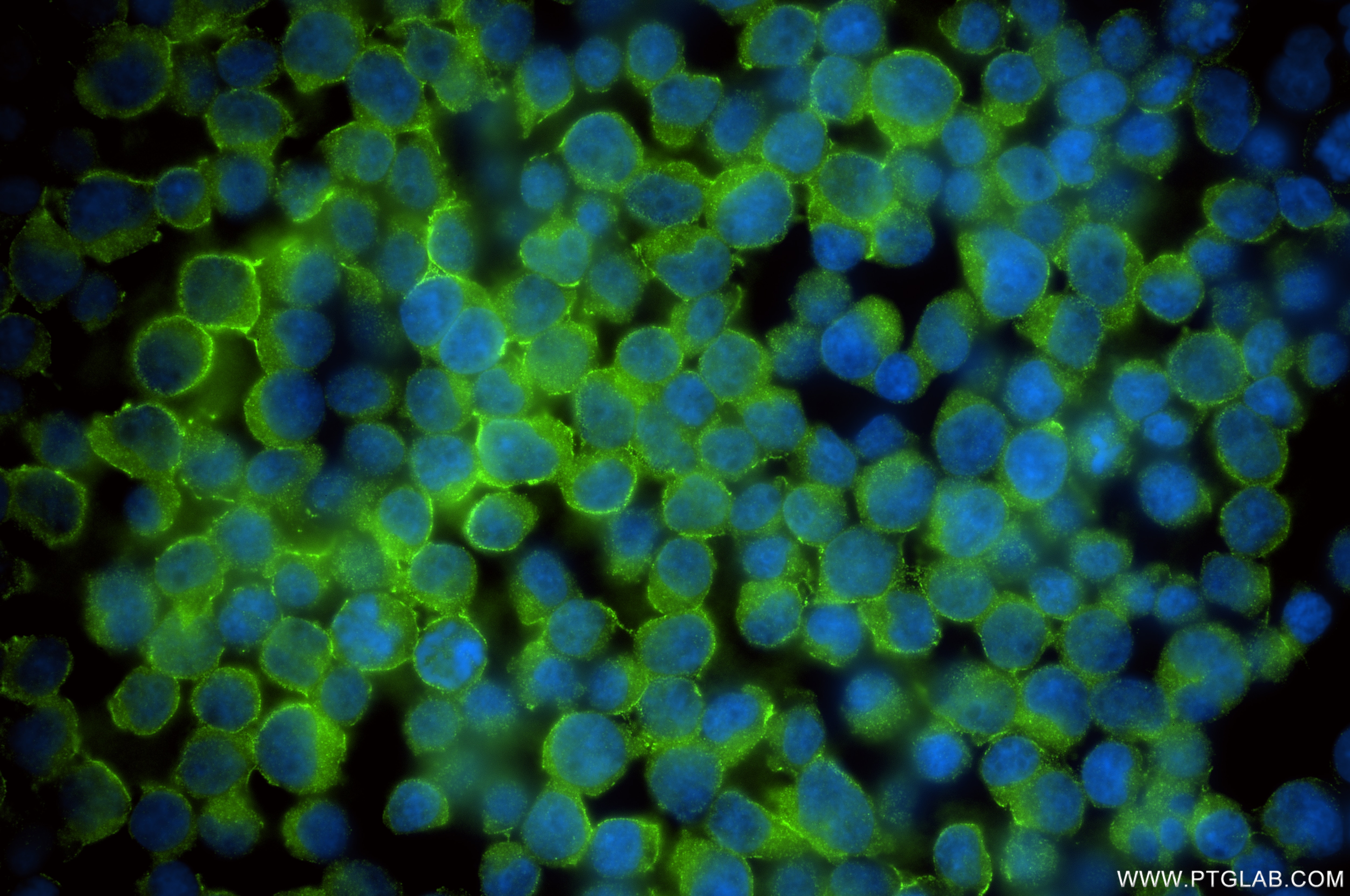 L-Plastin antibody (86299-3-PBS) | Proteintech