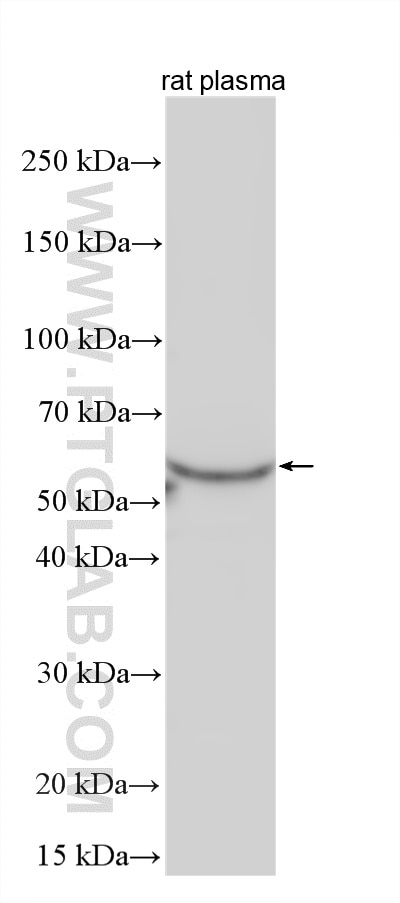 LCAT antibody (33293-1-AP) | Proteintech